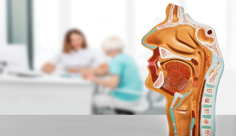 Nasopharyngeal carcinoma: Symptoms, diagnosis, and treatment