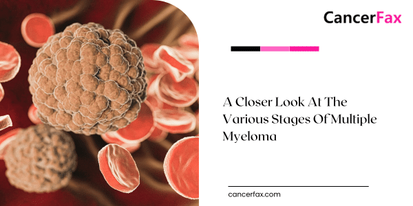 What Are the Stages and Types of Multiple Myeloma?